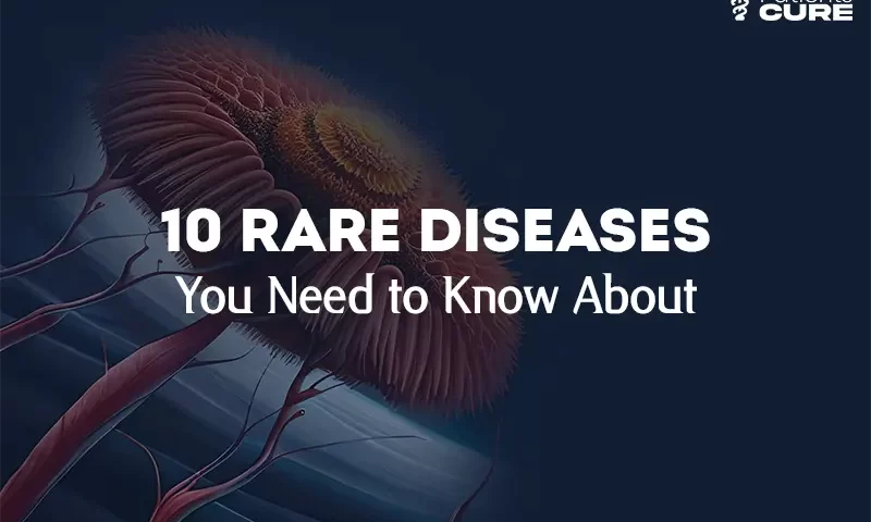 10 Rare Diseases You Need to Know About - PatientsCure