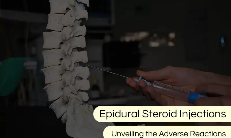 Unveiling the Adverse Reactions of Epidural Steroid Injections